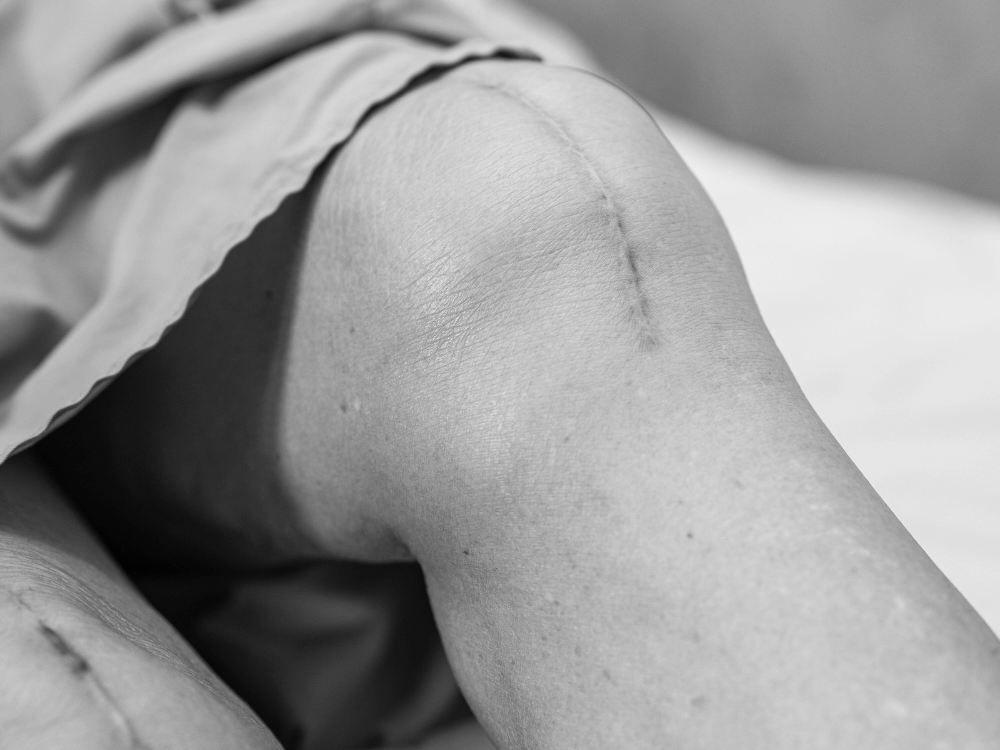 Reposo absoluto o relativo: Claves para una recuperación eficiente